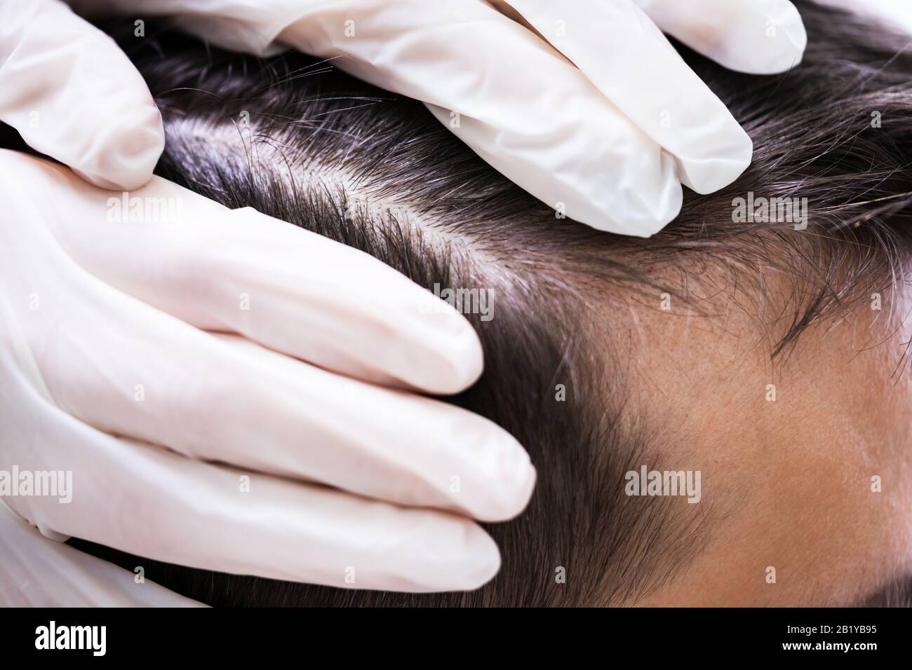 Skin check up hi-res stock photography and images - Alamy