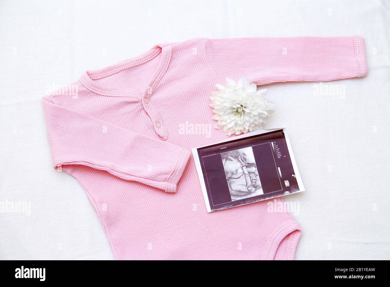 Ultrasound scan picture hi-res stock photography and images - Alamy