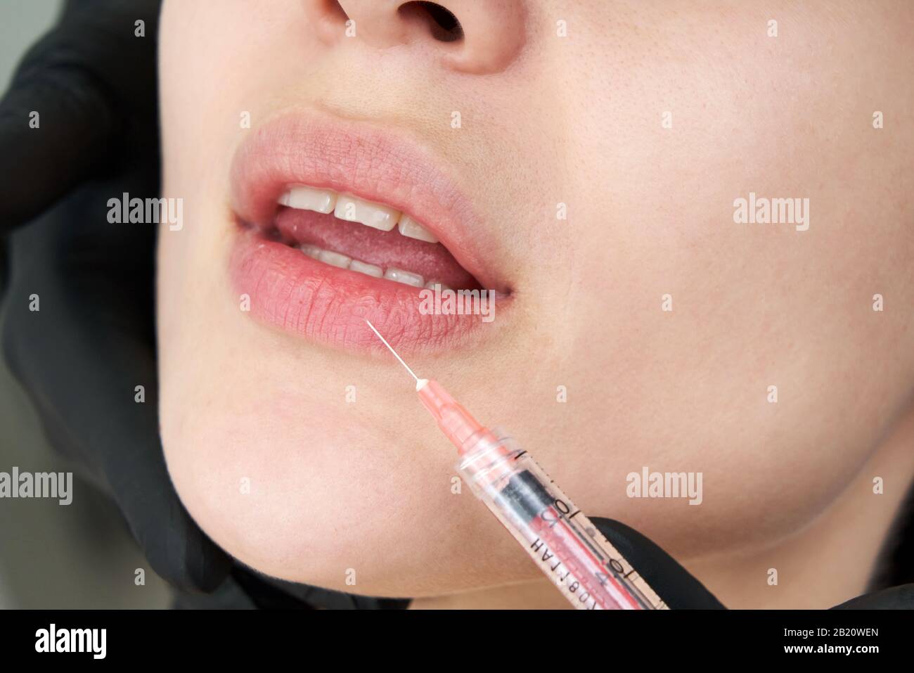 Beautiful woman gets an injection in lips Stock Photo - Alamy