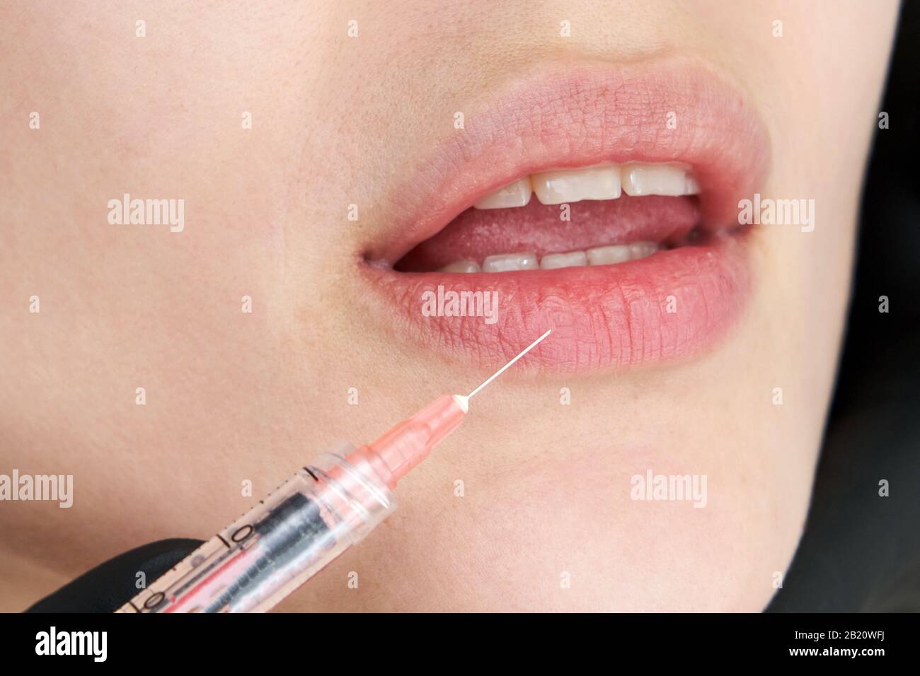 Beautiful woman gets an injection in lips Stock Photo - Alamy