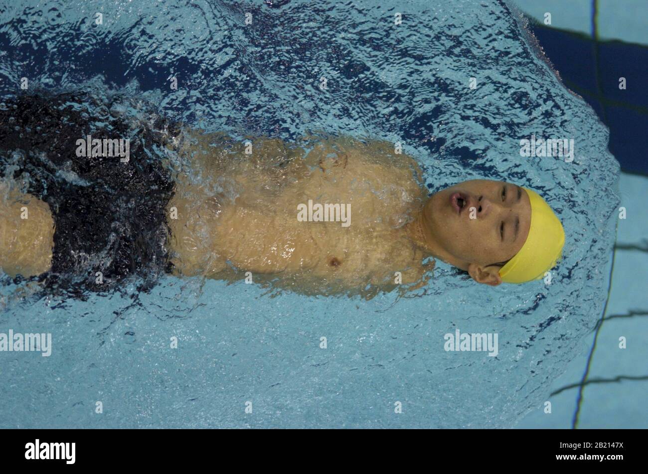 Double Amputee High Resolution Stock Photography and Images - Alamy
