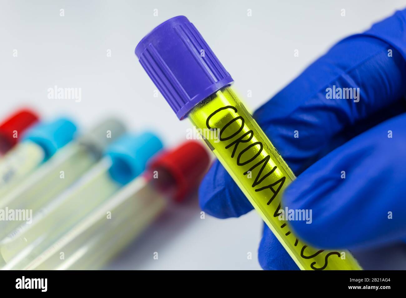 Coronavirus COVID-19 samples and test in a medical laboratory tubes ...