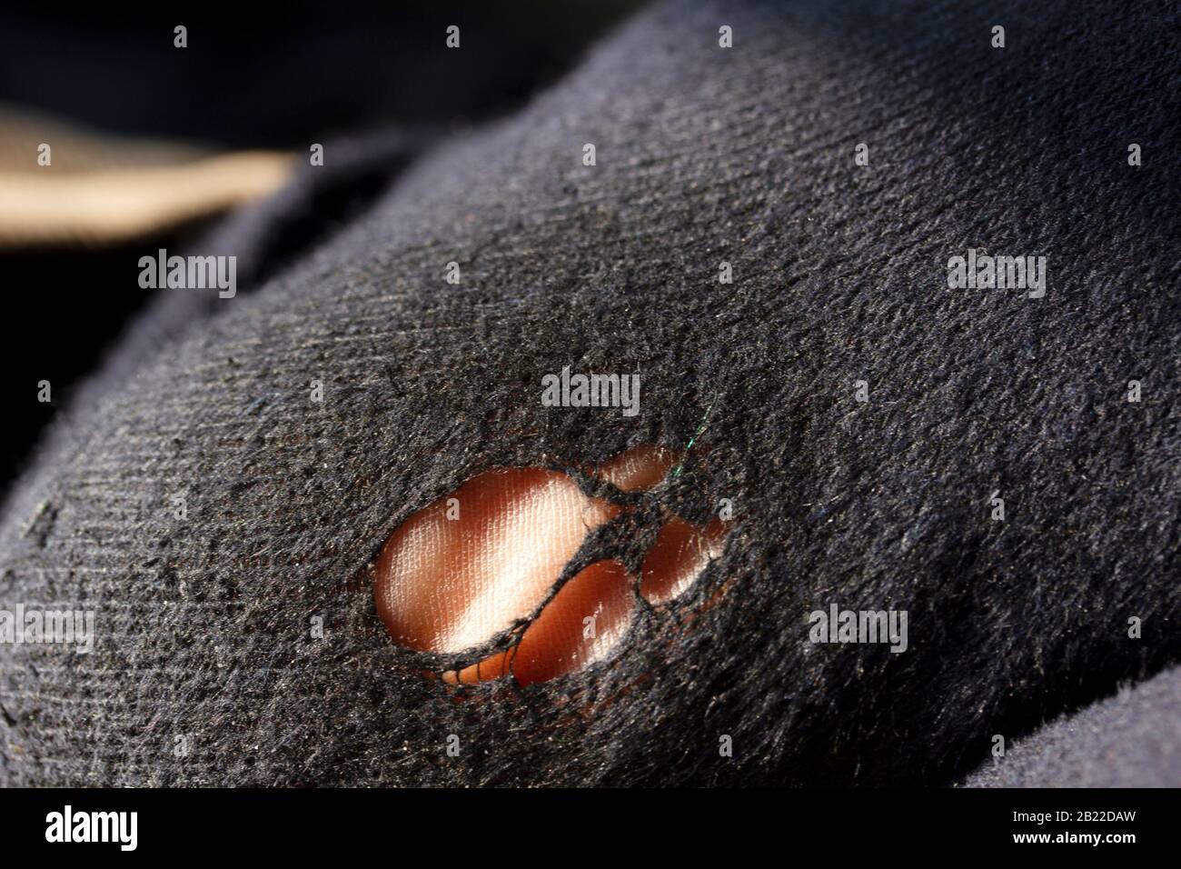 Blue Torn Socks. Man with worn socks Stock Photo - Alamy