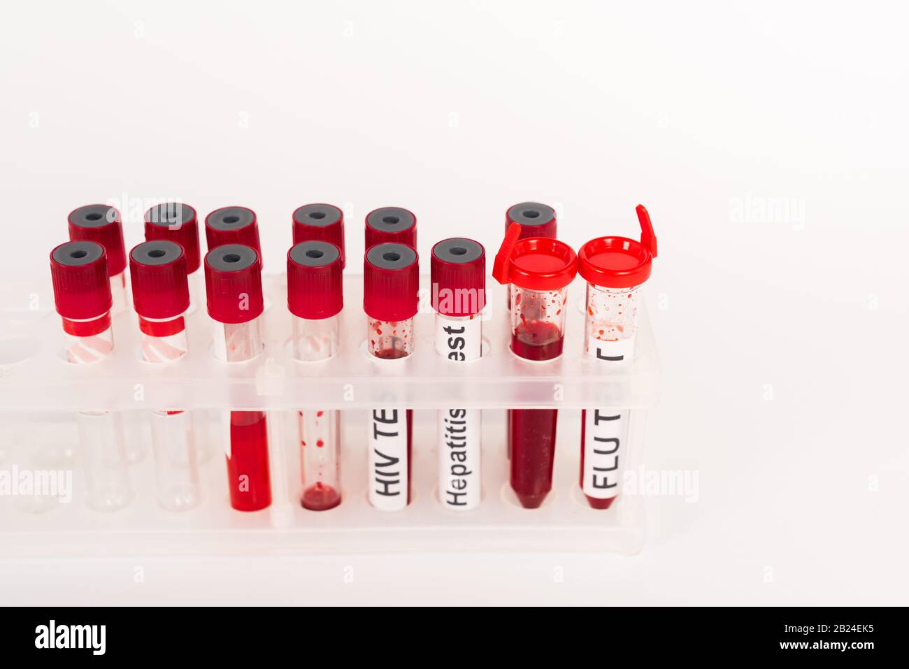 test tubes with blood samples and lettering isolated on white Stock ...