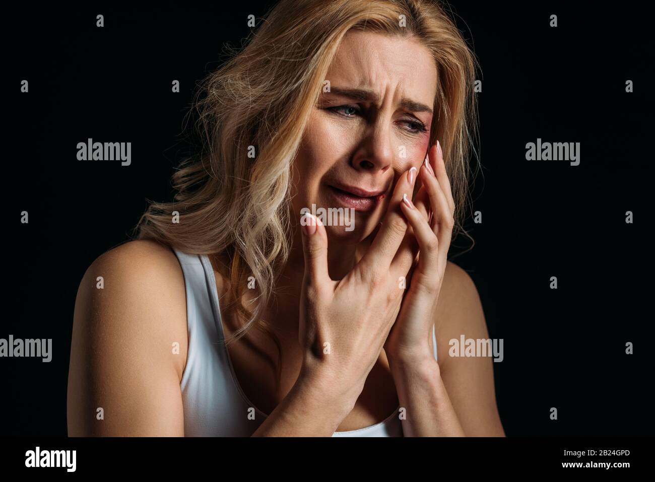 Woman crying and touching face with bruise isolated on black Stock ...
