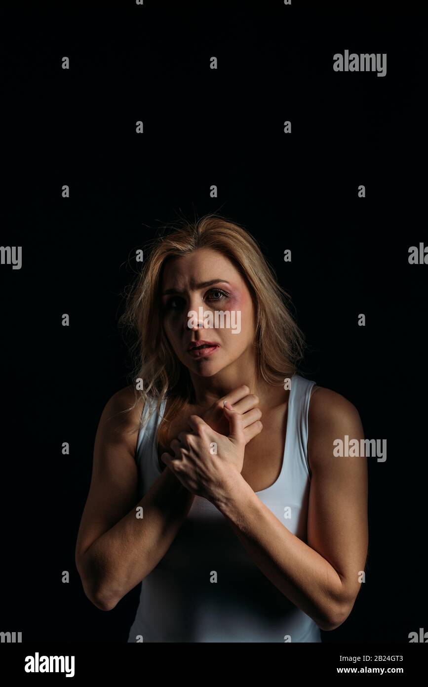 Scared Victim with bruise on face and clenched hands looking at camera ...