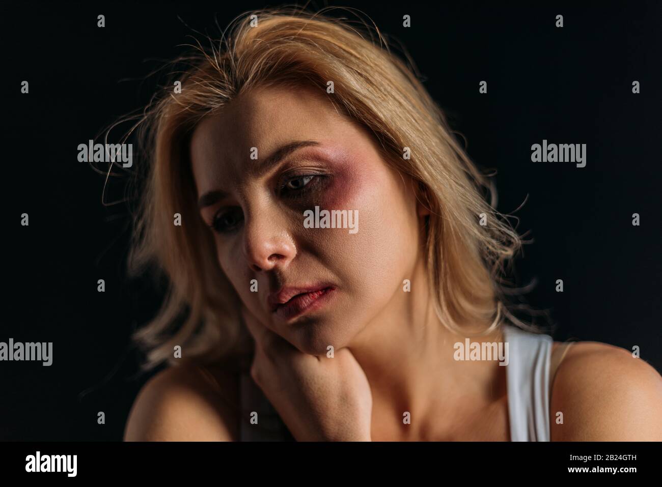 Thoughtful woman with bruises on face isolated on black Stock Photo - Alamy