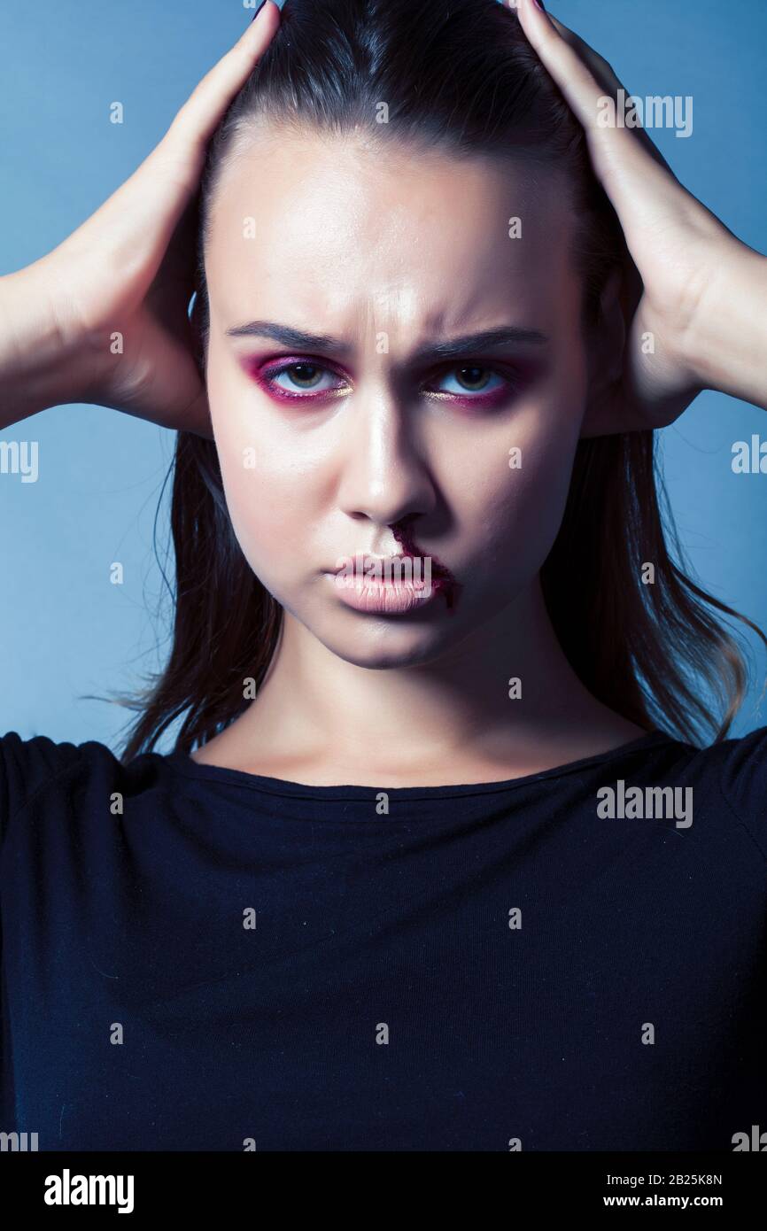 problem depressioned teenager with bleeding nose, real junky close up ...