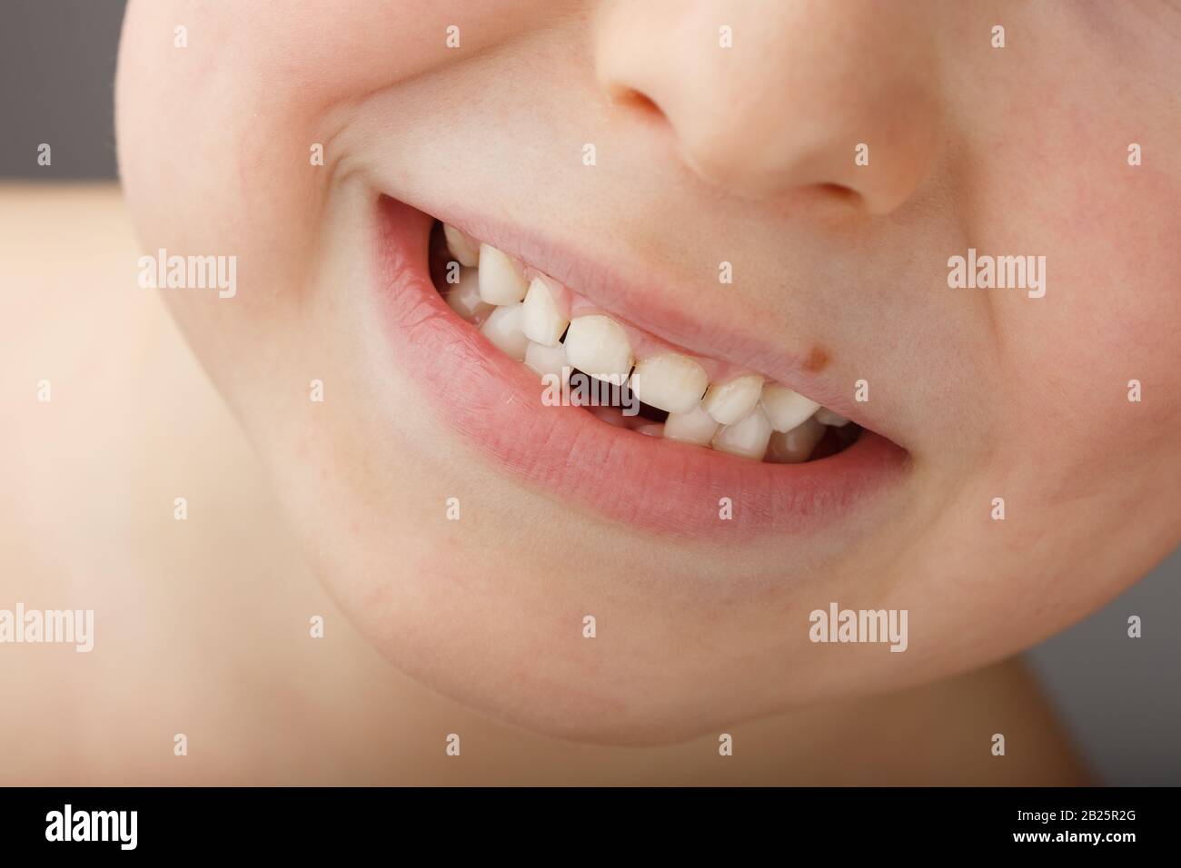 A child's smile without lower baby teeth. A hole in a child's smile ...