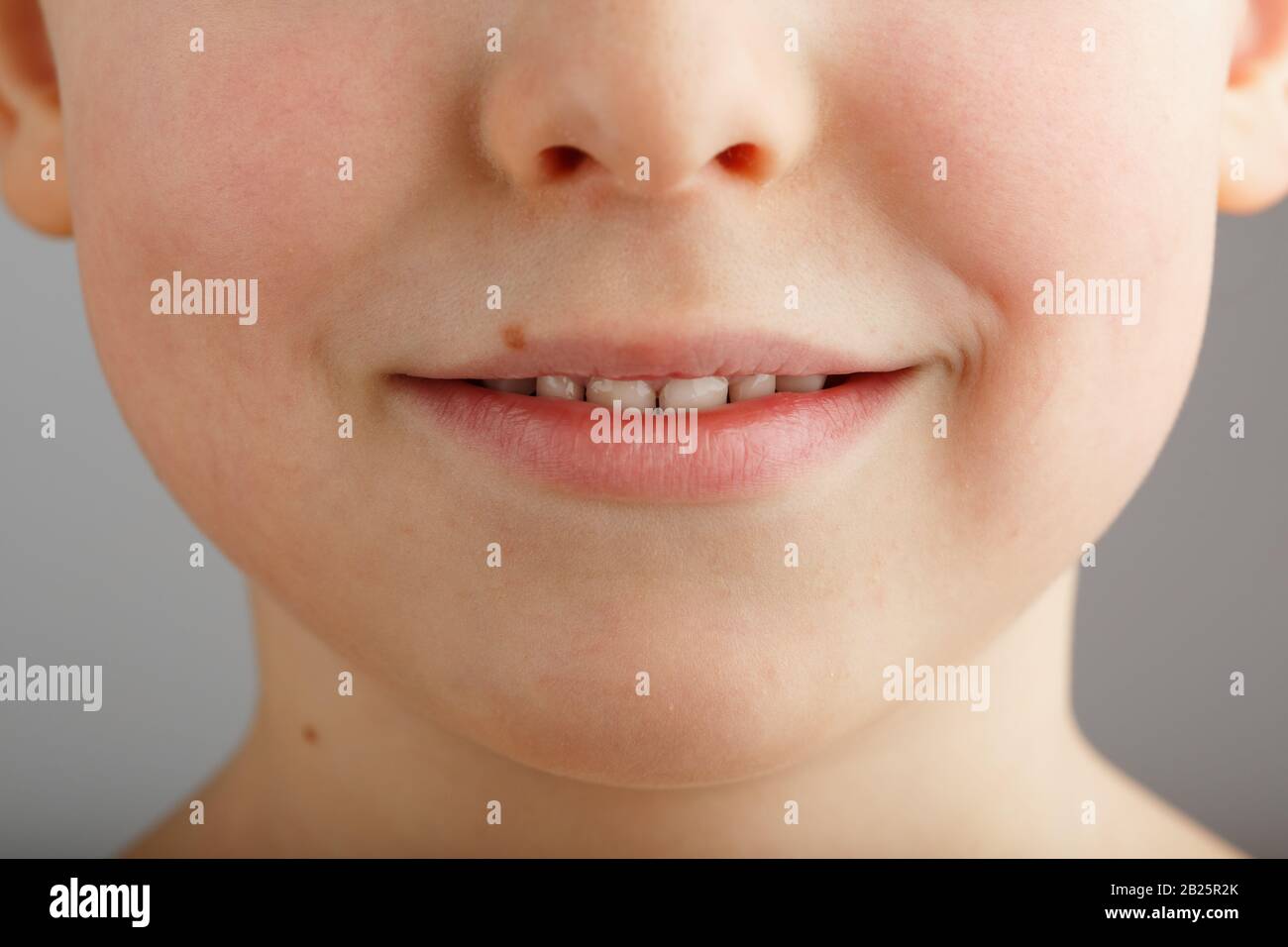A child's smile in a frame, lips part of the face. Portrait of a ...
