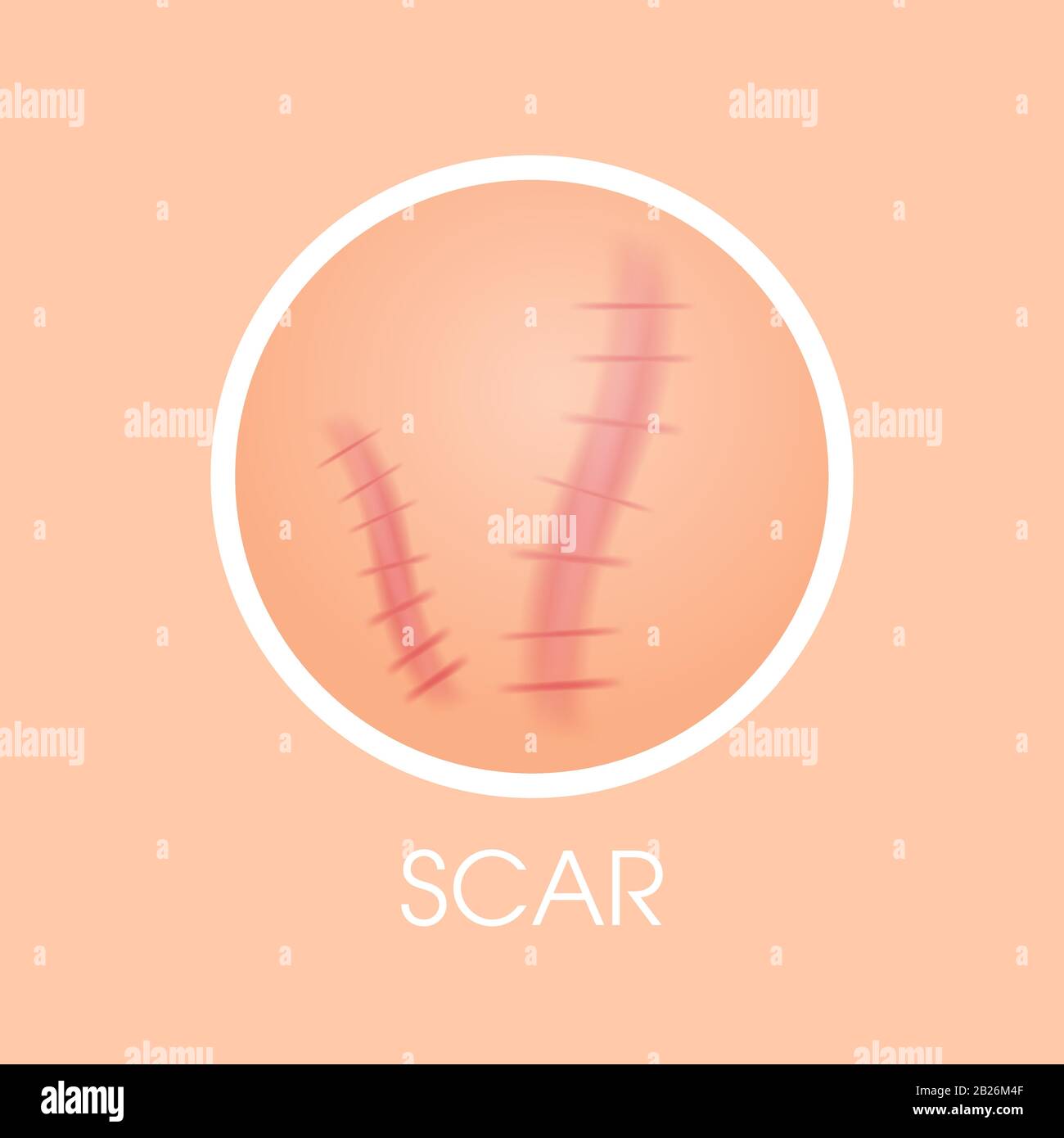 skin scars acne type face pore comedones cosmetology skincare problems ...