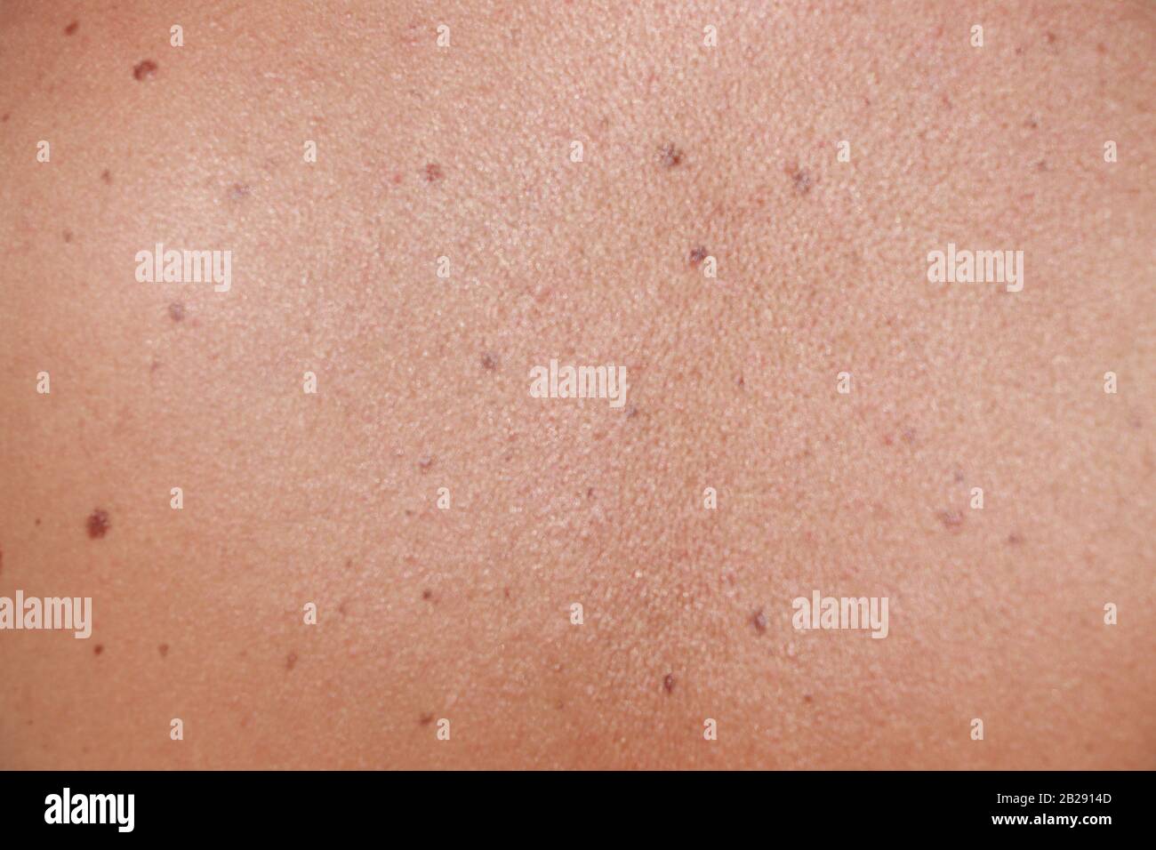 Human skin texture hi-res stock photography and images - Alamy