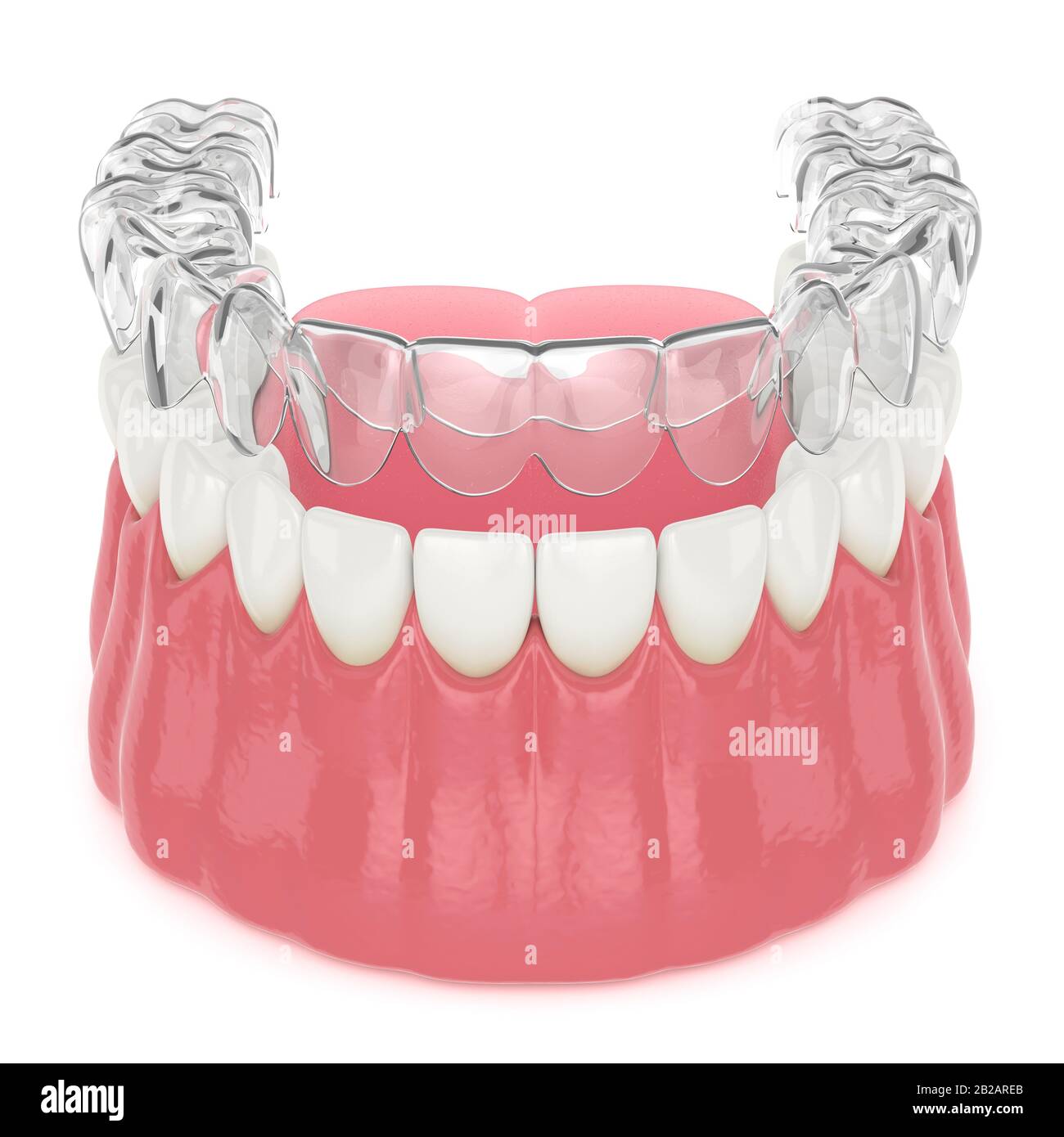 3d render of invisalign removable and invisible retainer with lower jaw ...