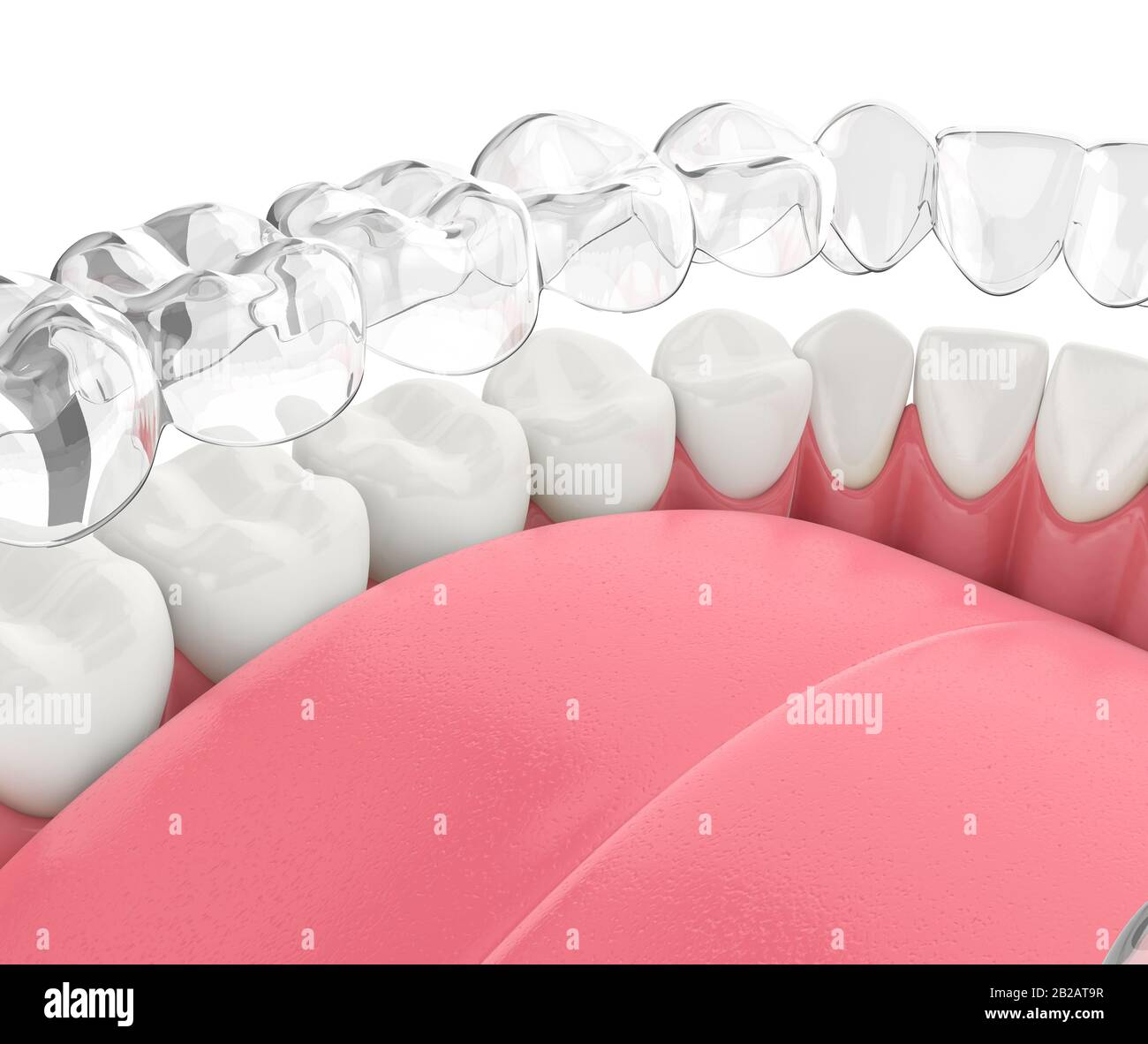 3d render of invisalign removable and invisible retainer with lower jaw ...