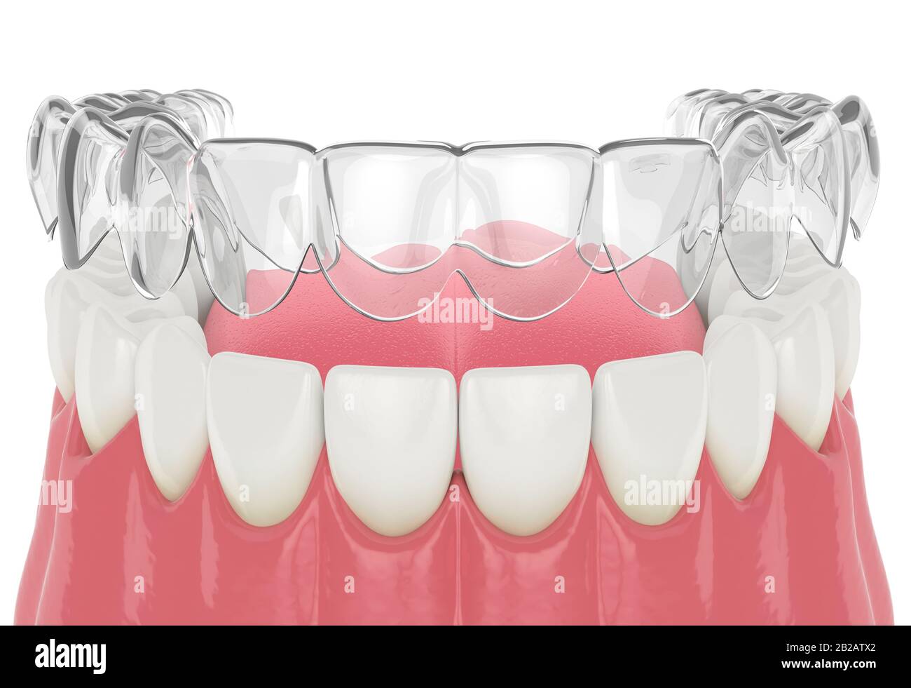3d render of invisalign removable and invisible retainer with lower jaw ...
