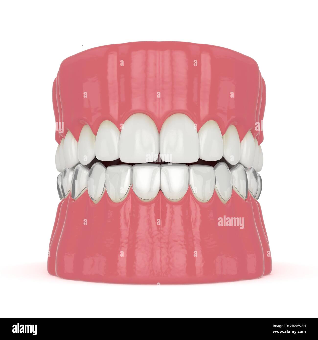 3d render of invisalign removable and invisible retainer with lower jaw ...