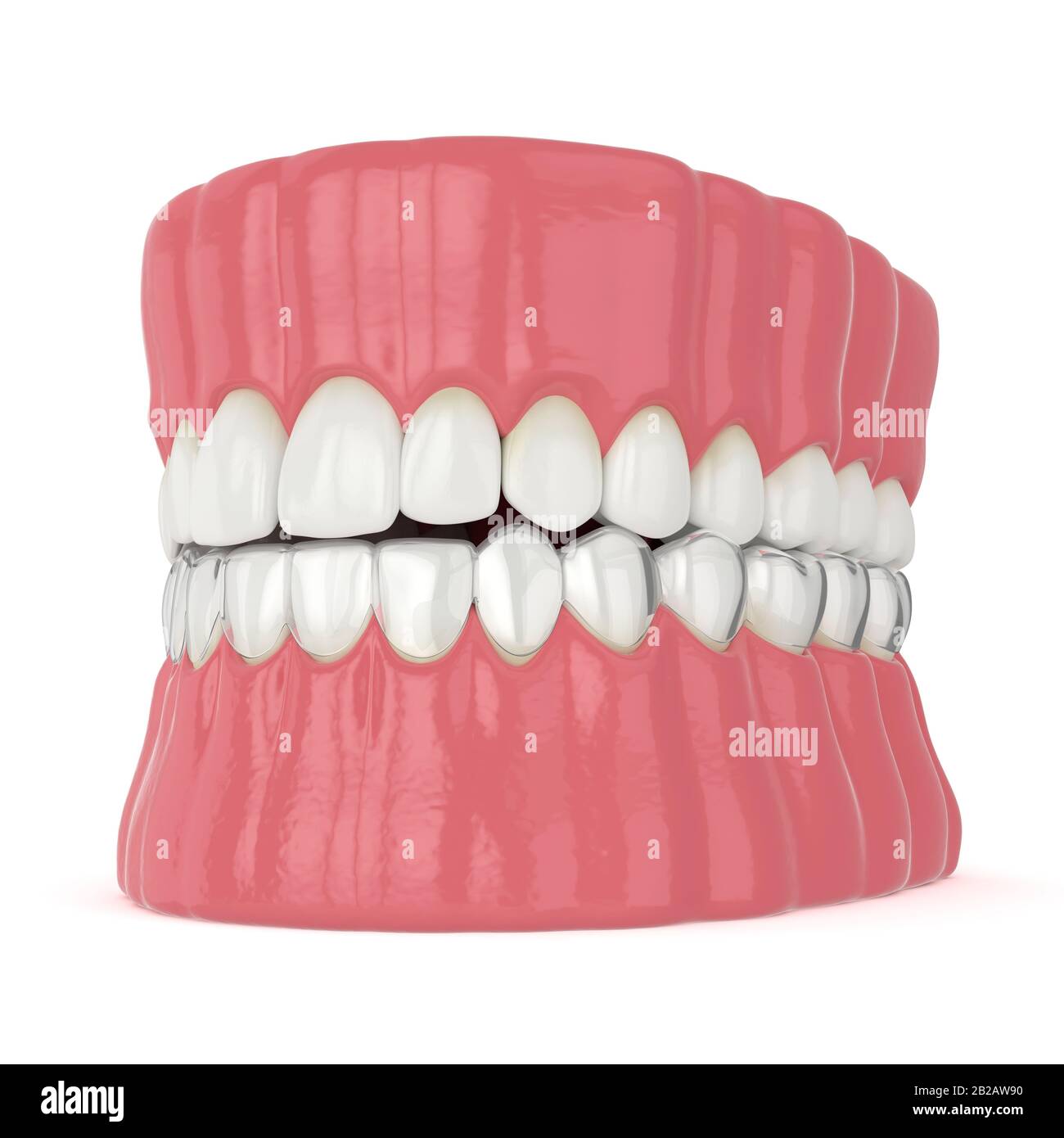 3d render of invisalign removable and invisible retainer with lower jaw ...