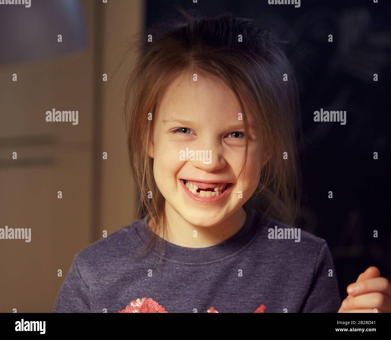 A school-age girl without a front tooths is laughing. Close-up. Change ...