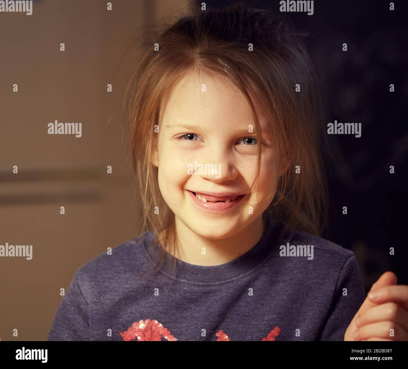 A school-age girl without a front tooths is laughing. Close-up. Change ...
