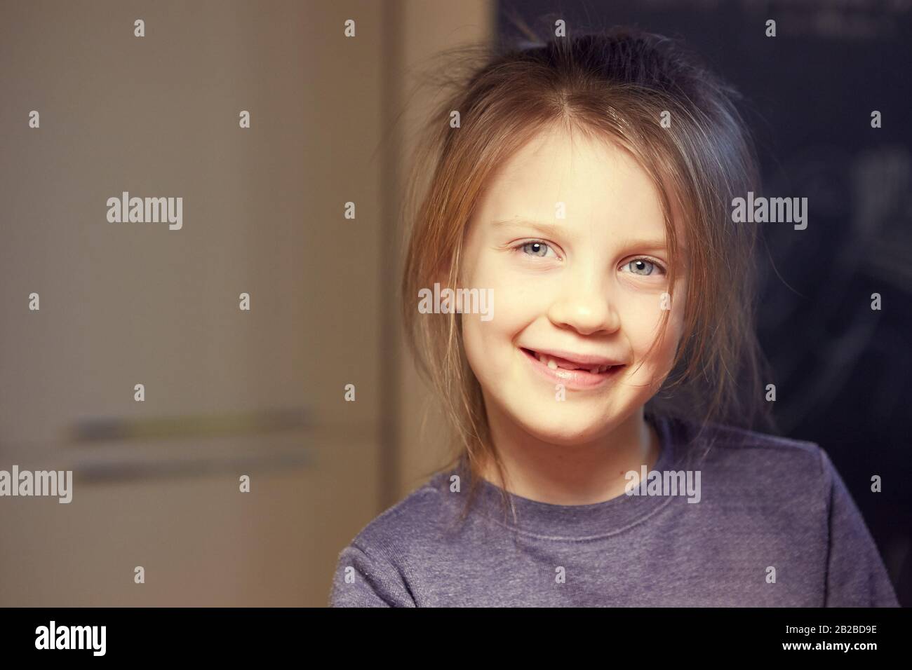 A school-age girl without a front tooths is laughing. Close-up. Change ...