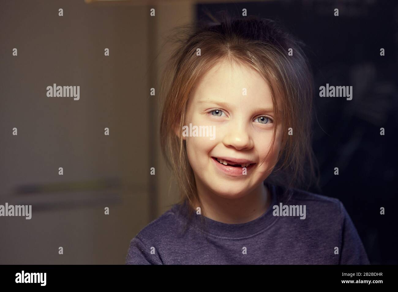 A school-age girl without a front tooths is laughing. Close-up. Change ...
