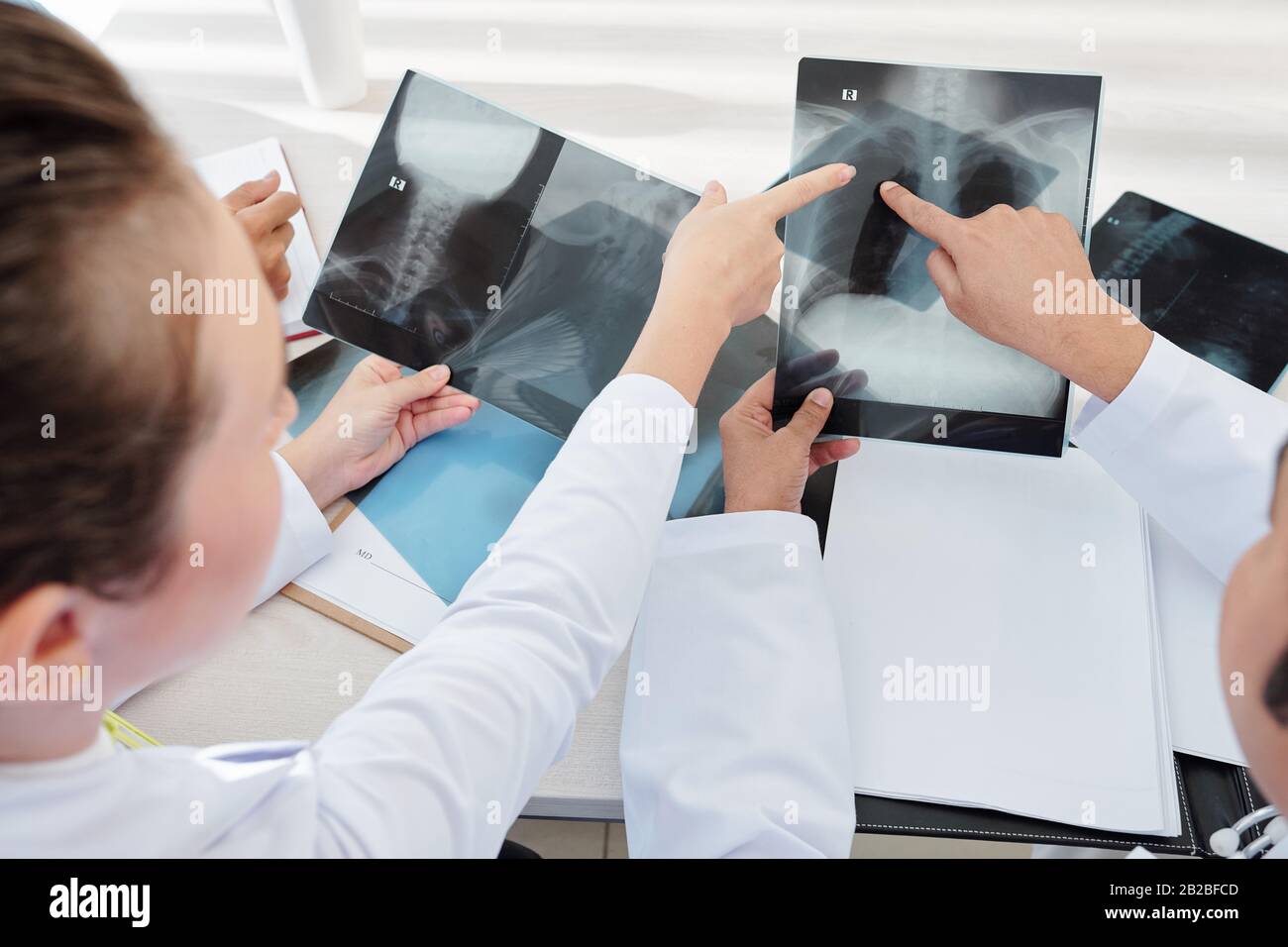 Doctors pointing at chest x-ray of patient with coronavirus infection ...
