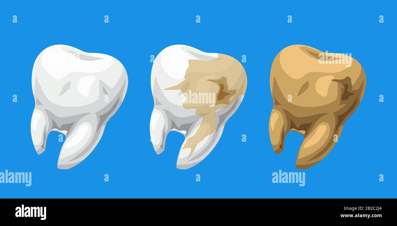 cartoon teeth healthy and caries Stock Vector Image & Art - Alamy