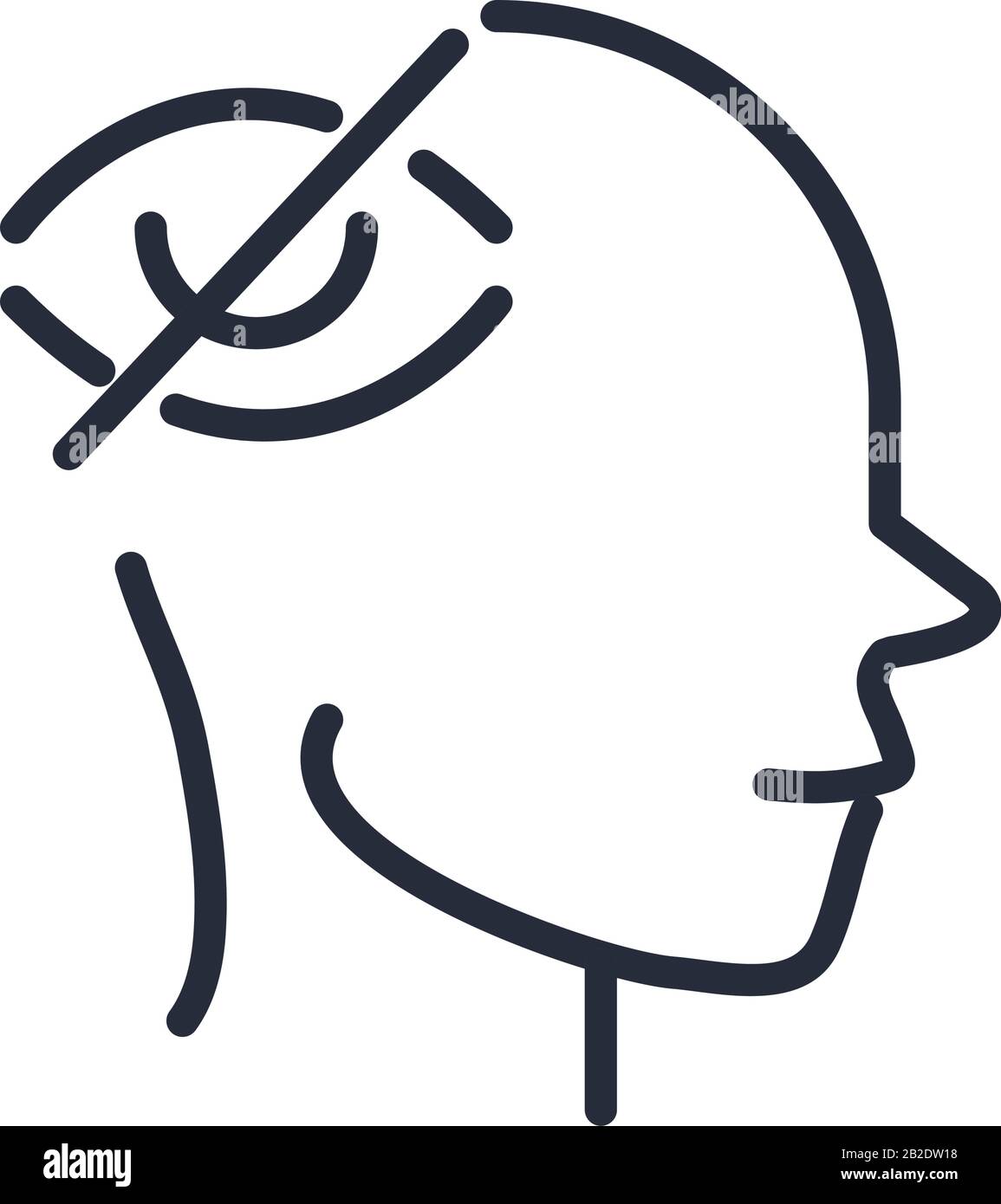 alzheimers disease neurological brain vision problems vector ...