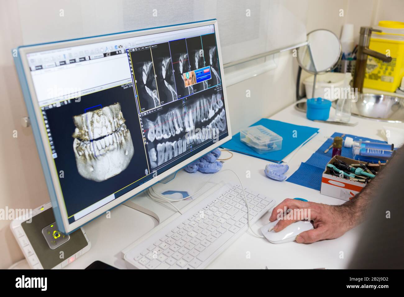 Dentist examining a patient's x-ray on the computer screen Stock Photo ...