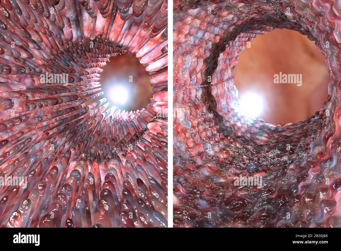 Villous hi-res stock photography and images - Alamy