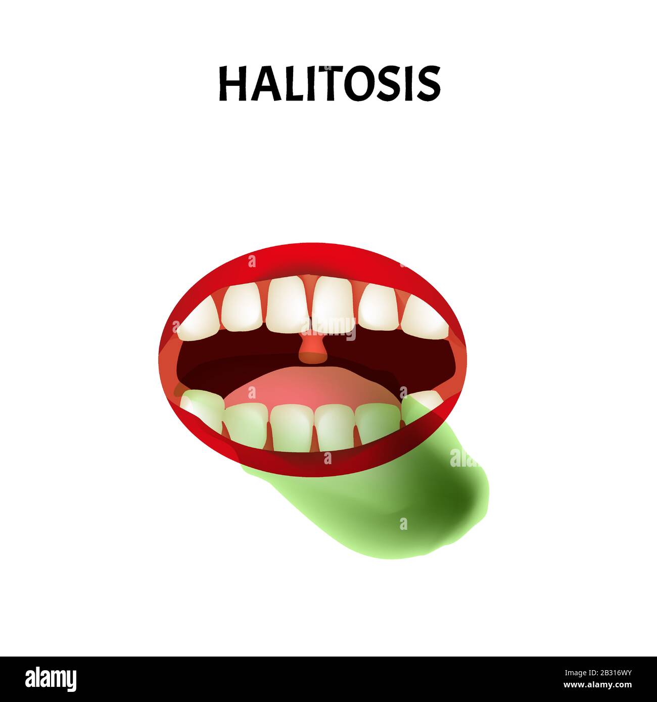 bad breath. Halitosis. The structure of the teeth and oral cavity ...