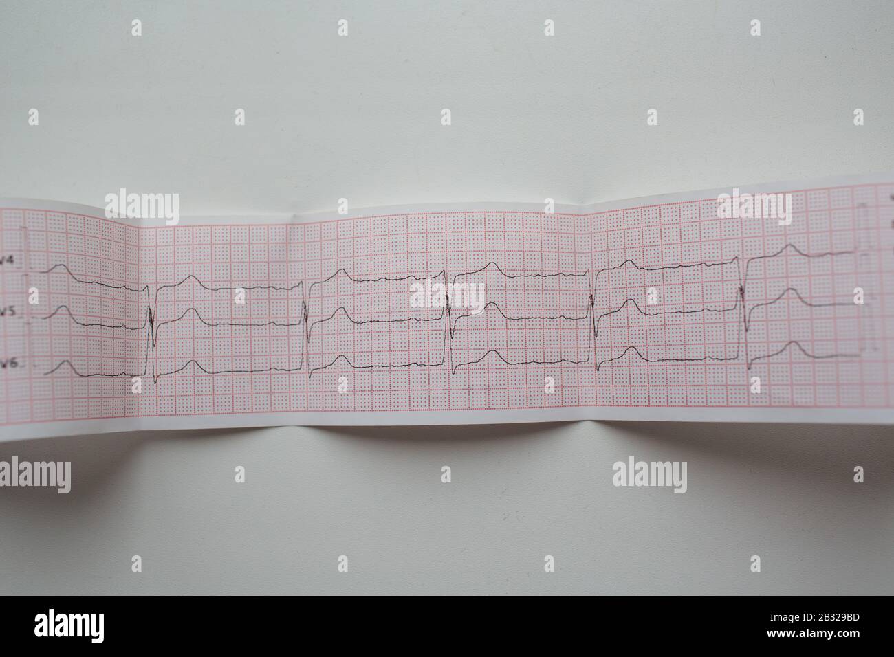 Hospital chart heart monitor hi-res stock photography and images - Alamy