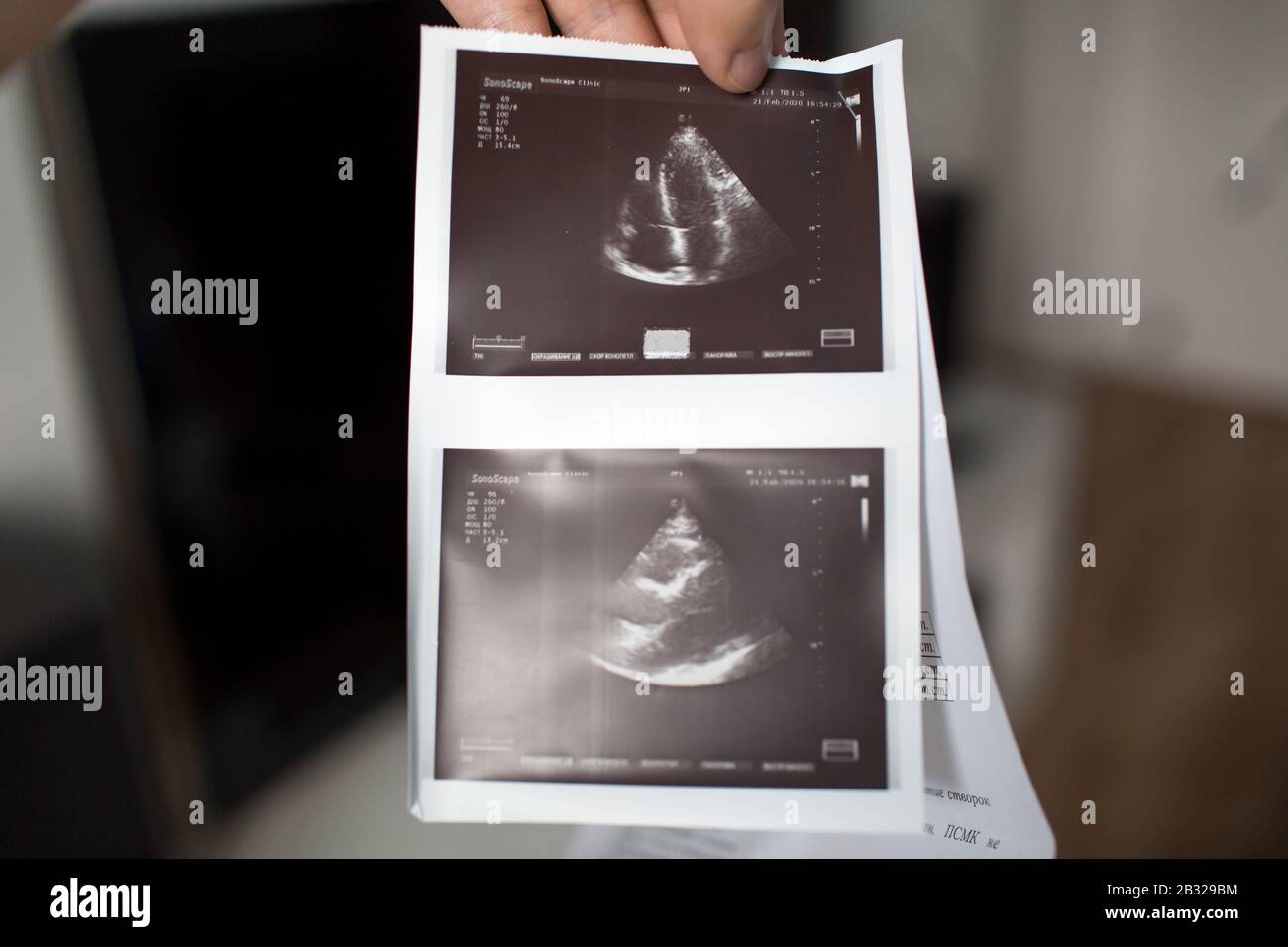 Ultrasound machine monitor examination heart hi-res stock photography ...