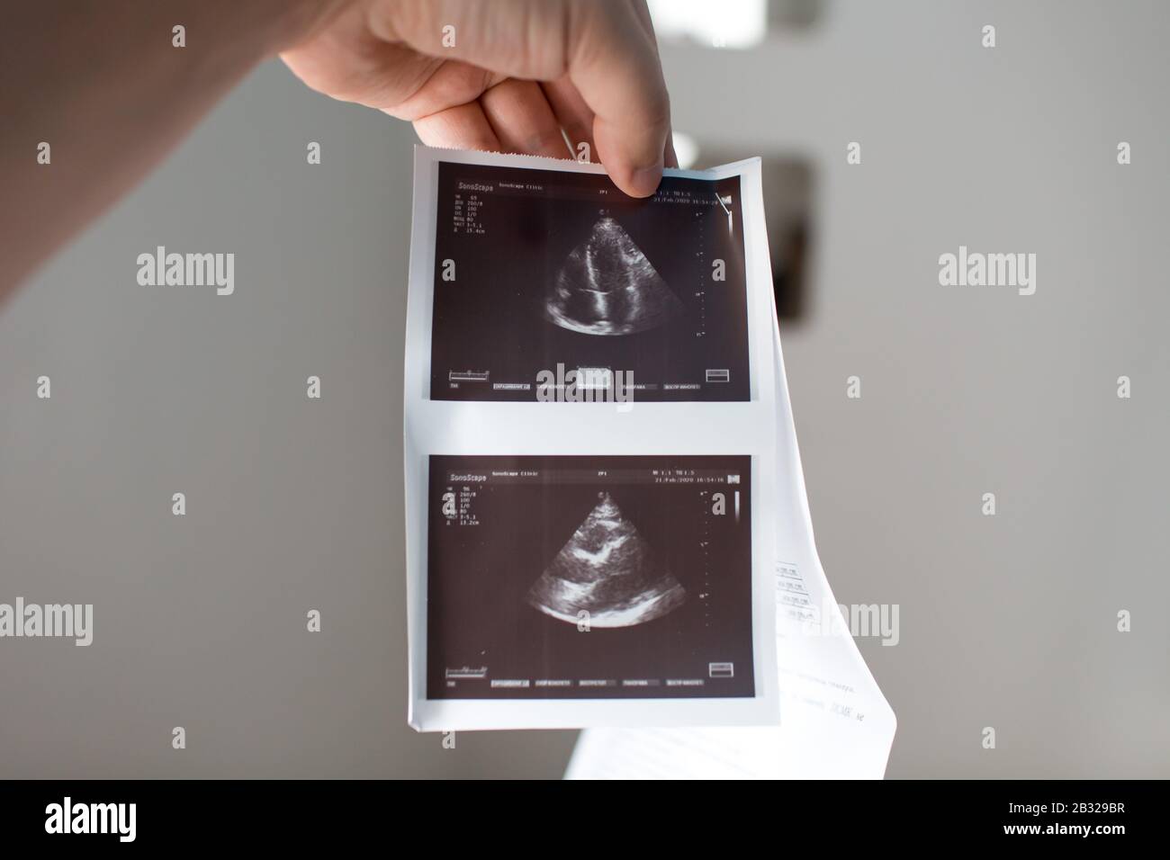 Ultrasound machine monitor examination heart hi-res stock photography ...