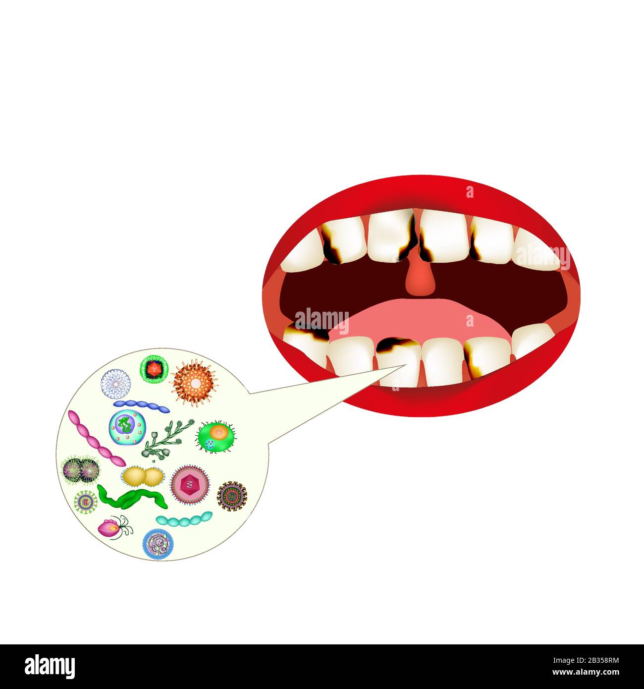 caries. Smell from the mouth. Halitosis. The structure of the teeth and ...