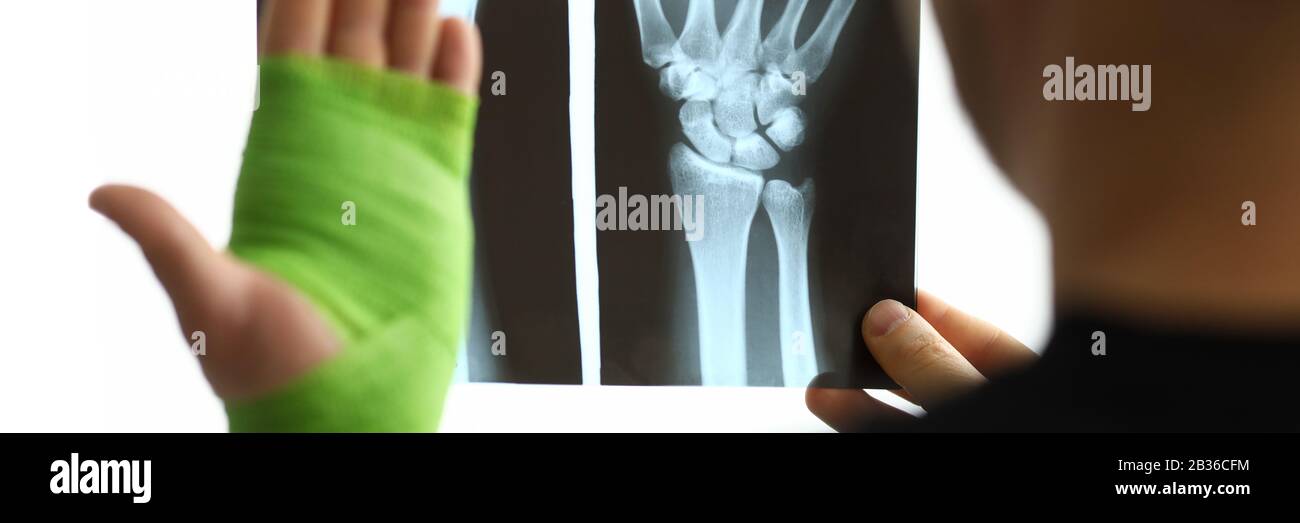 Hand ct scan High Resolution Stock Photography and Images - Alamy