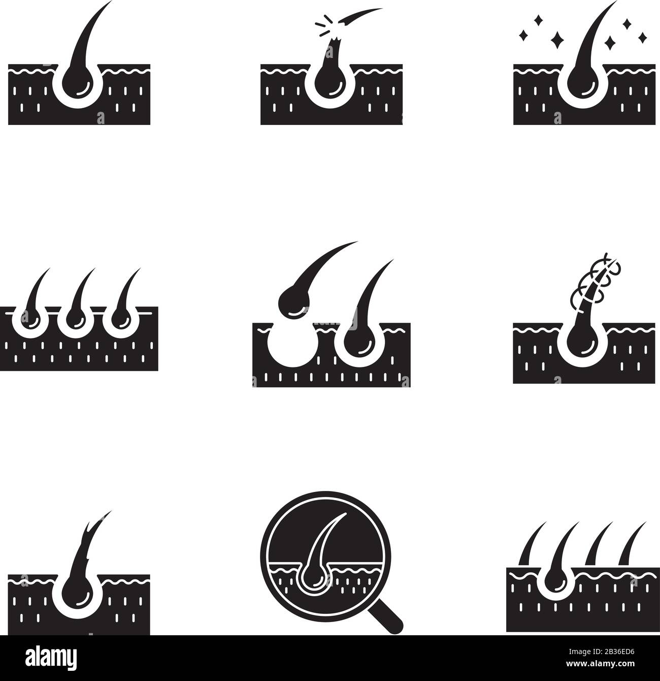 Negative strand Black and White Stock Photos & Images - Alamy