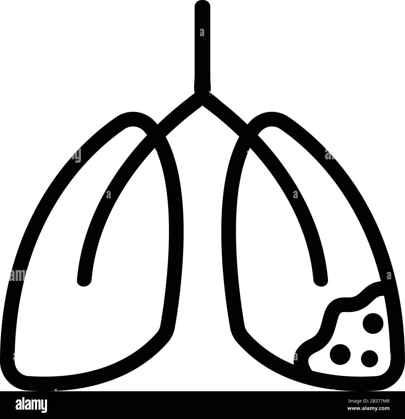 Lung cancer drawing Black and White Stock Photos & Images - Alamy