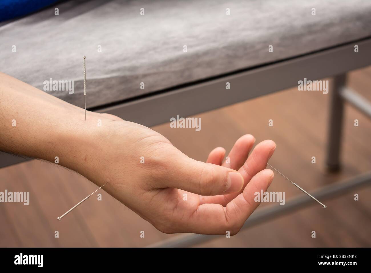 Acupuncture, the traditional chinese medicine Stock Photo - Alamy
