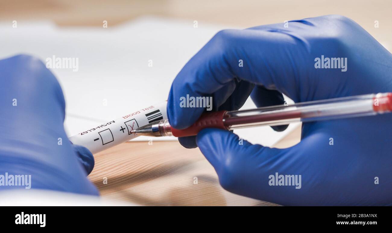 Doctor marking blood test hi-res stock photography and images - Alamy