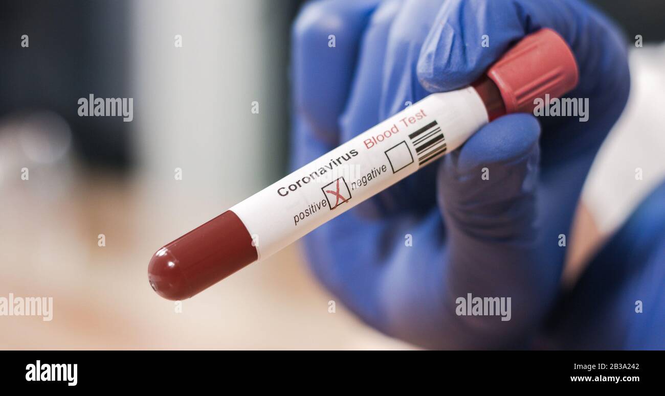 Coronavirus COVID-19 Infected Blood Sample in Doctor Scientist Hands ...