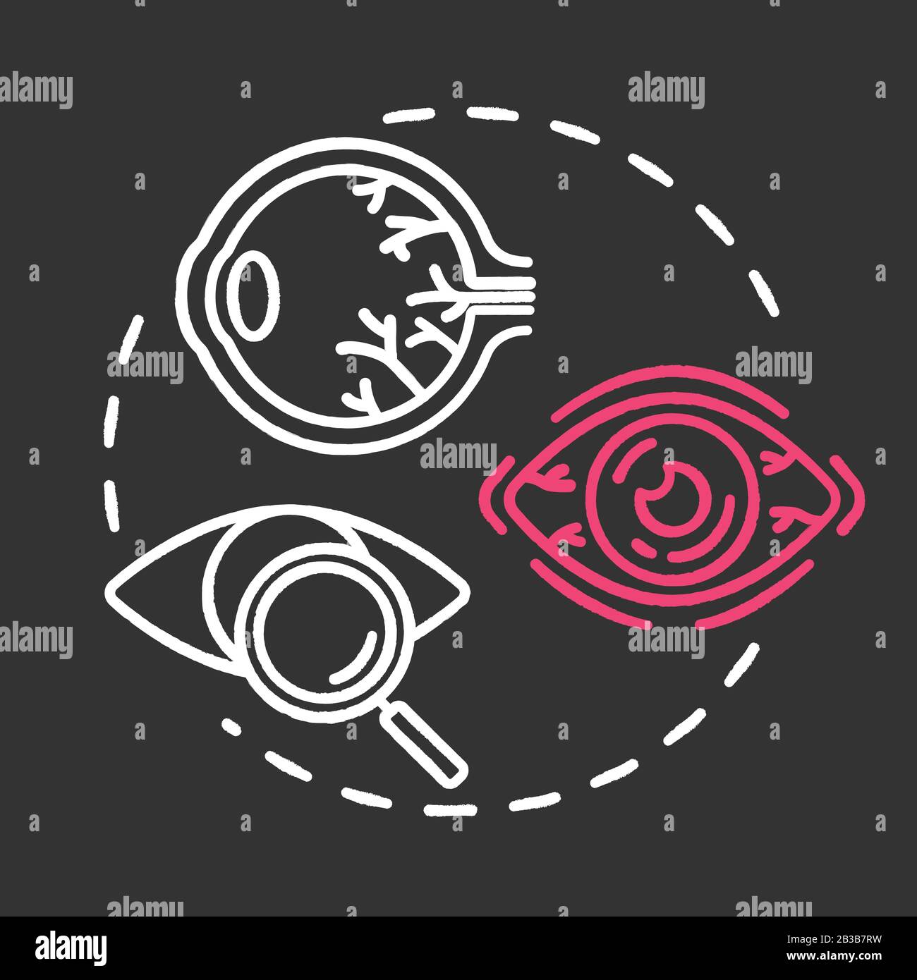 Ocular oncology chalk RGB color chalk RGB color concept icon. Eye ...