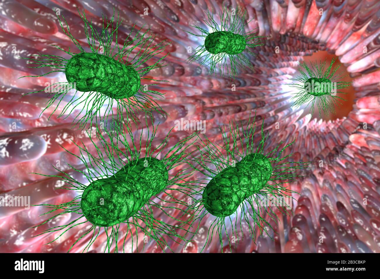 SIBO, small intestine bacterial overgrowth medical 3D illustration ...