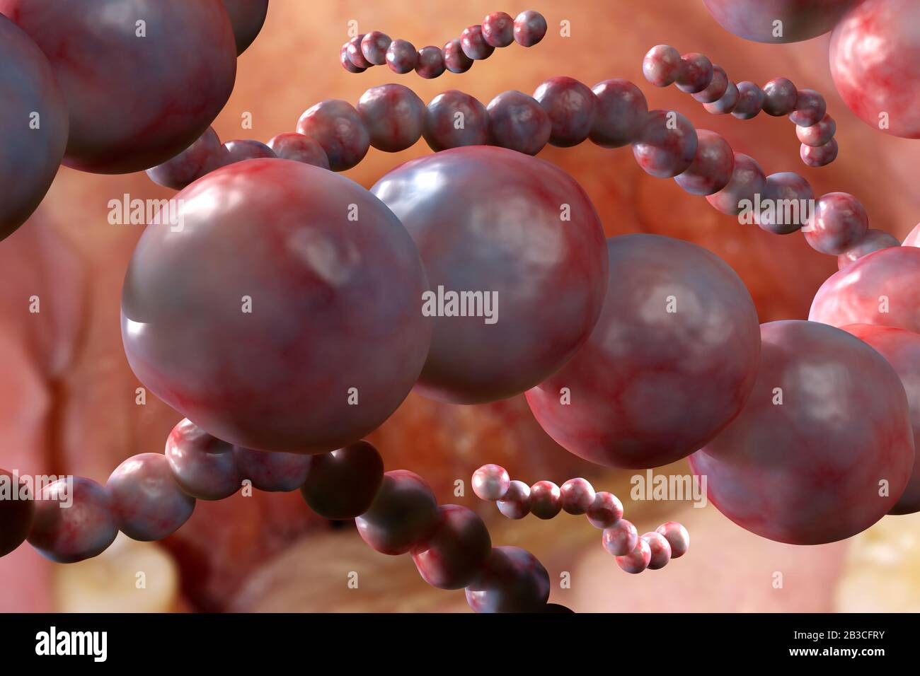 Strep throat also known as Streptococcus Pneumonia bacteria in mouth 3D ...