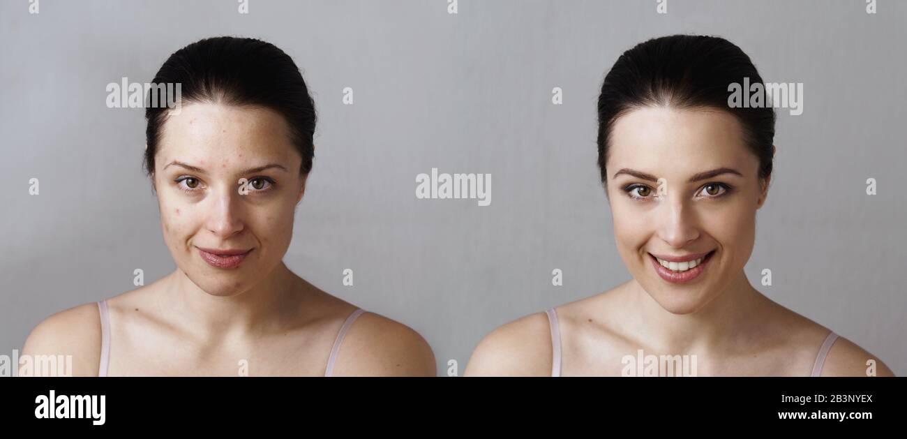 Unretouched hi-res stock photography and images - Alamy