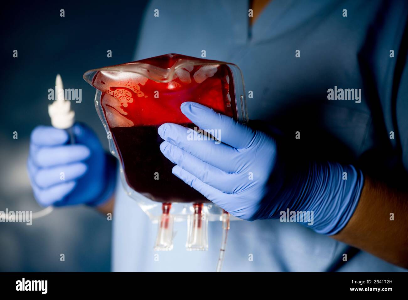 Nurse prepares donor IV blood unit for transfusion with dark background ...