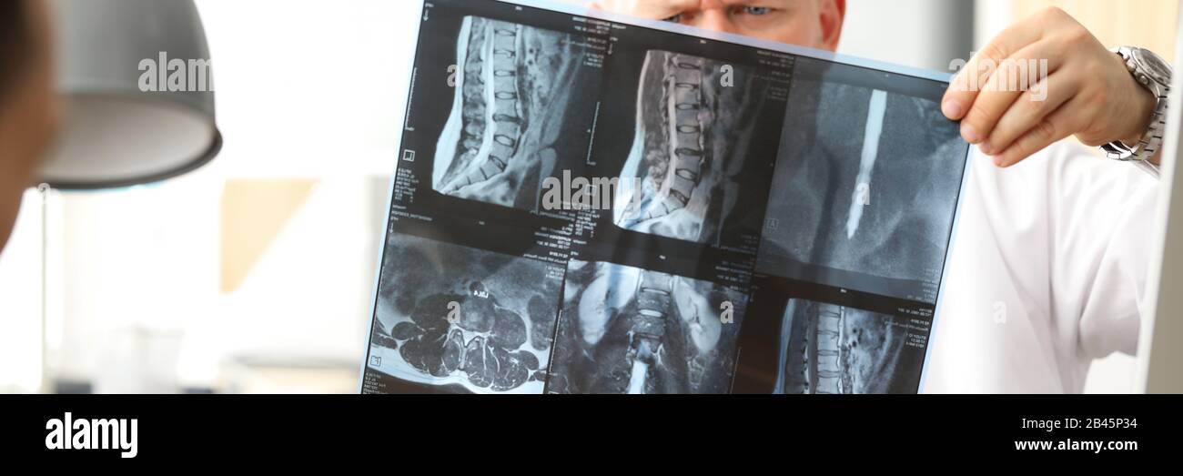 Radiologist showing x-ray Stock Photo - Alamy
