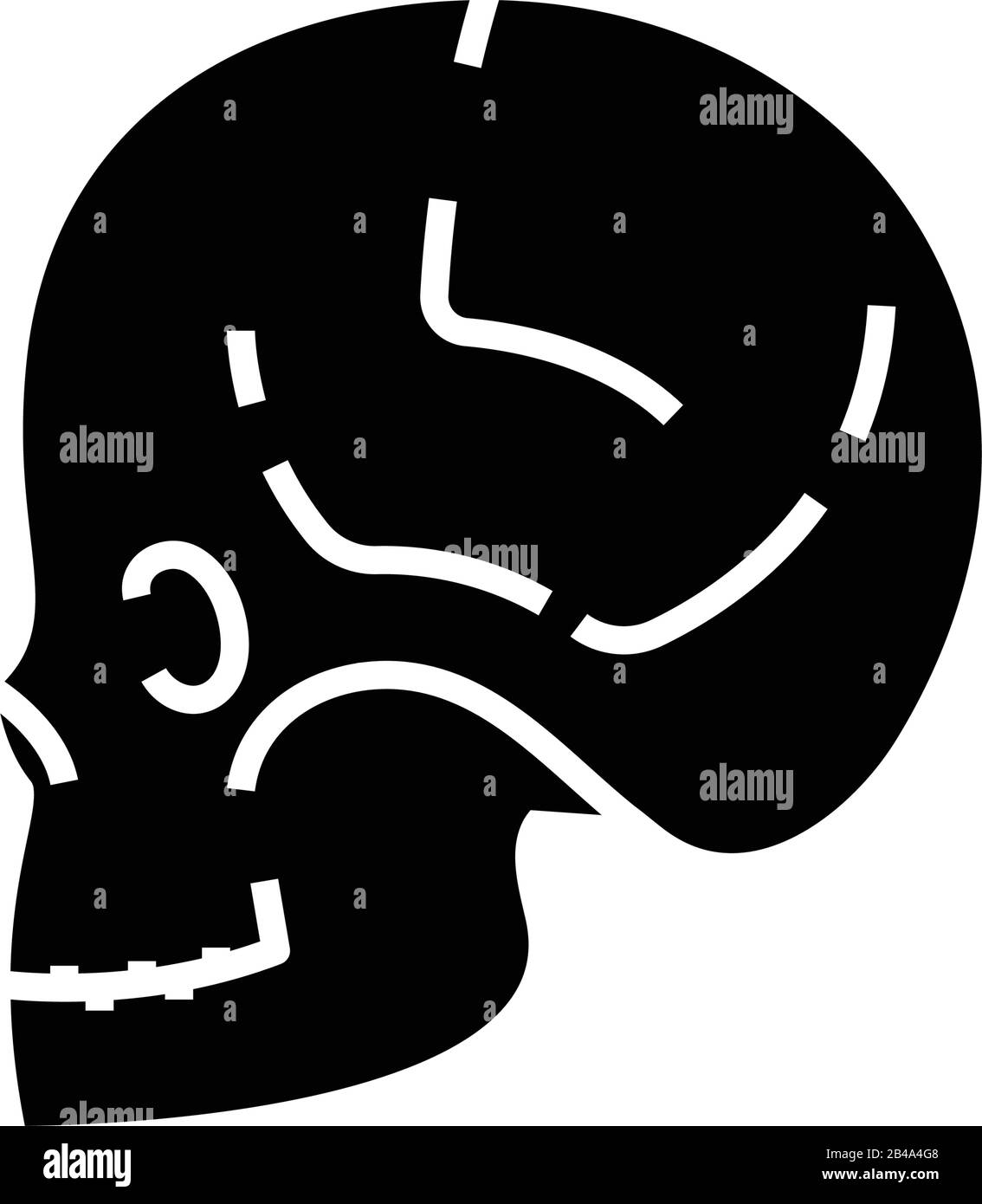 Skull diagnosis black icon, concept illustration, vector flat symbol ...