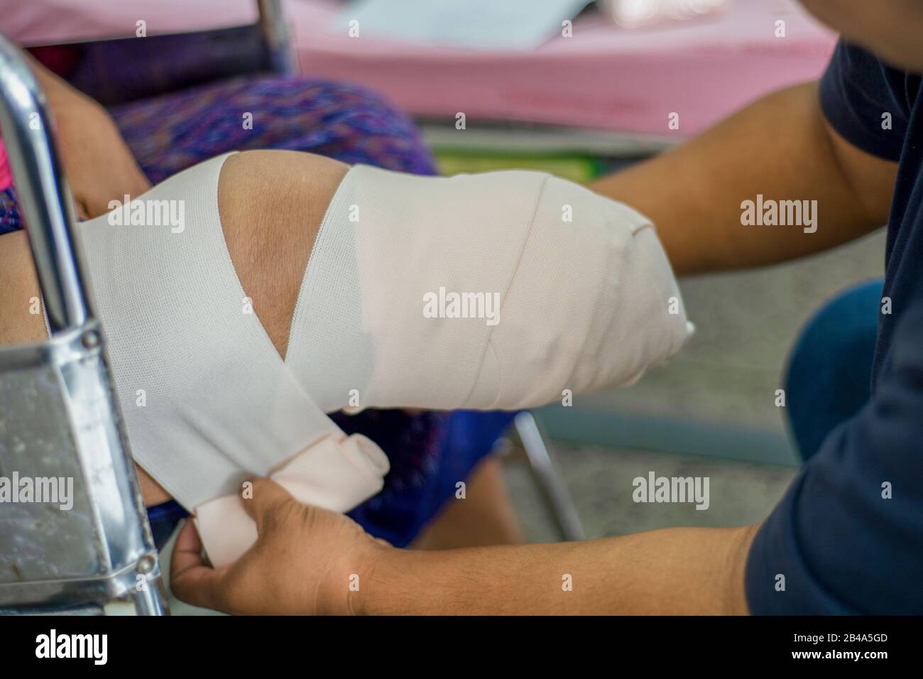 Below knee amputation stump hi-res stock photography and images - Alamy