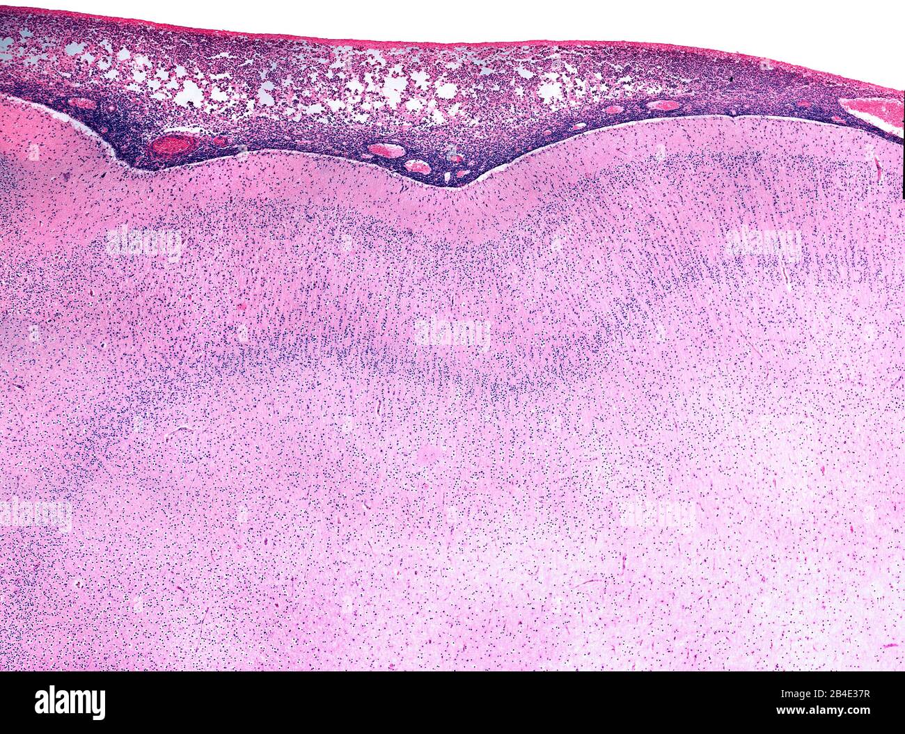 Haemophilus Influenzae Slide